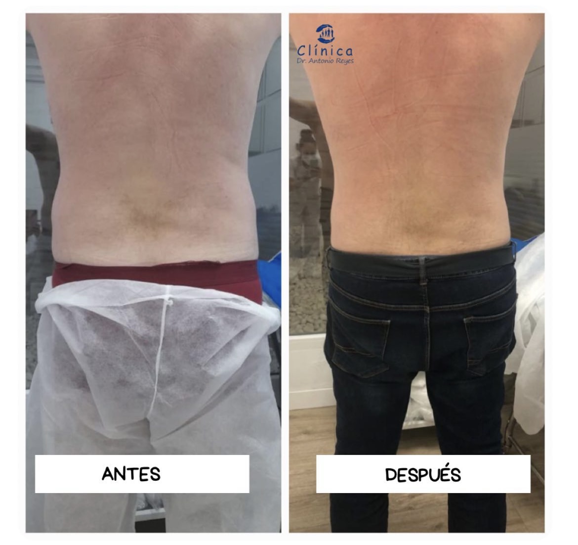 BELLACTION DUO CORPORAL :: clinicadrantonioreyes