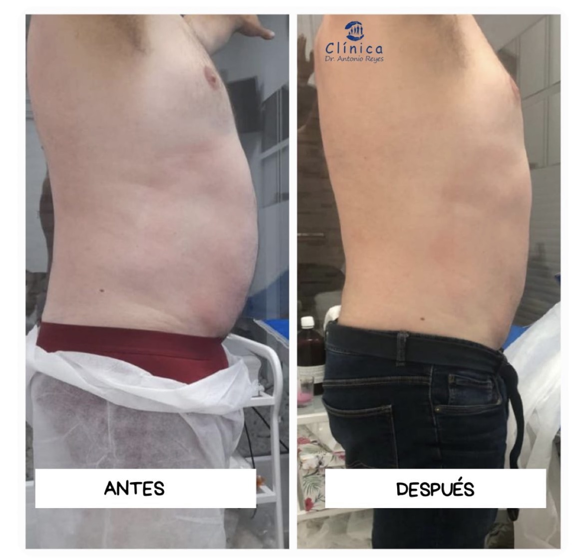 BELLACTION DUO CORPORAL :: clinicadrantonioreyes